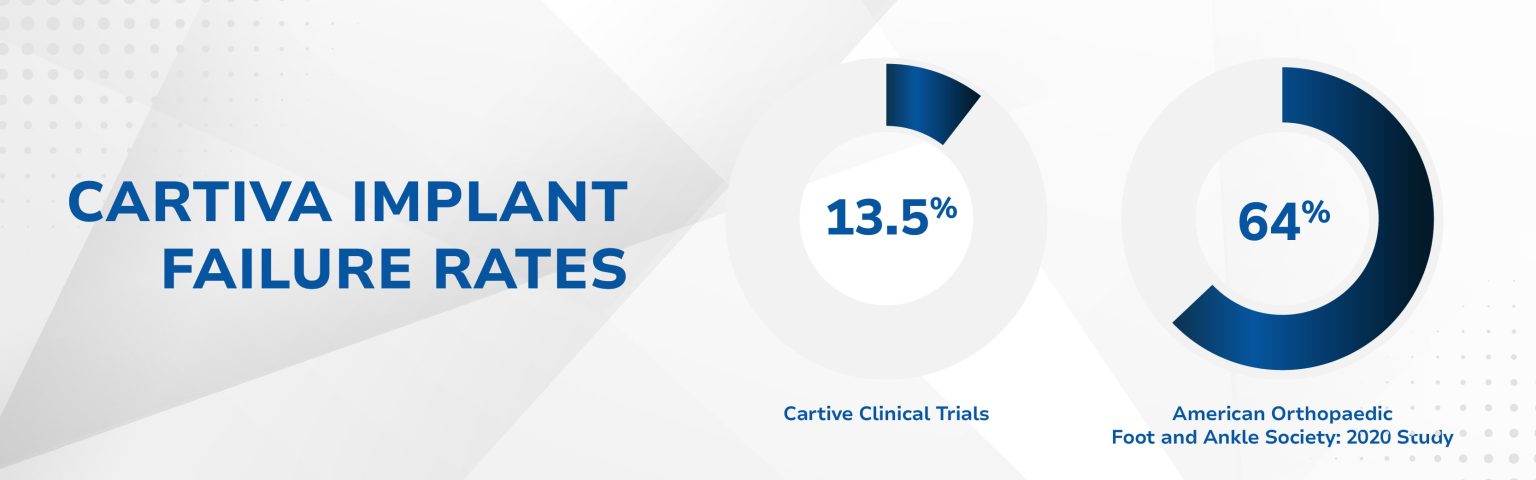 Cartiva Implant – Tort Experts