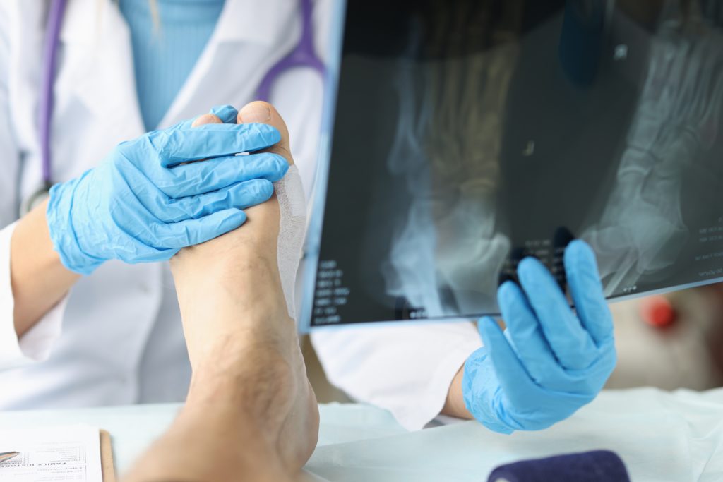 Cartiva Implant – Tort Experts